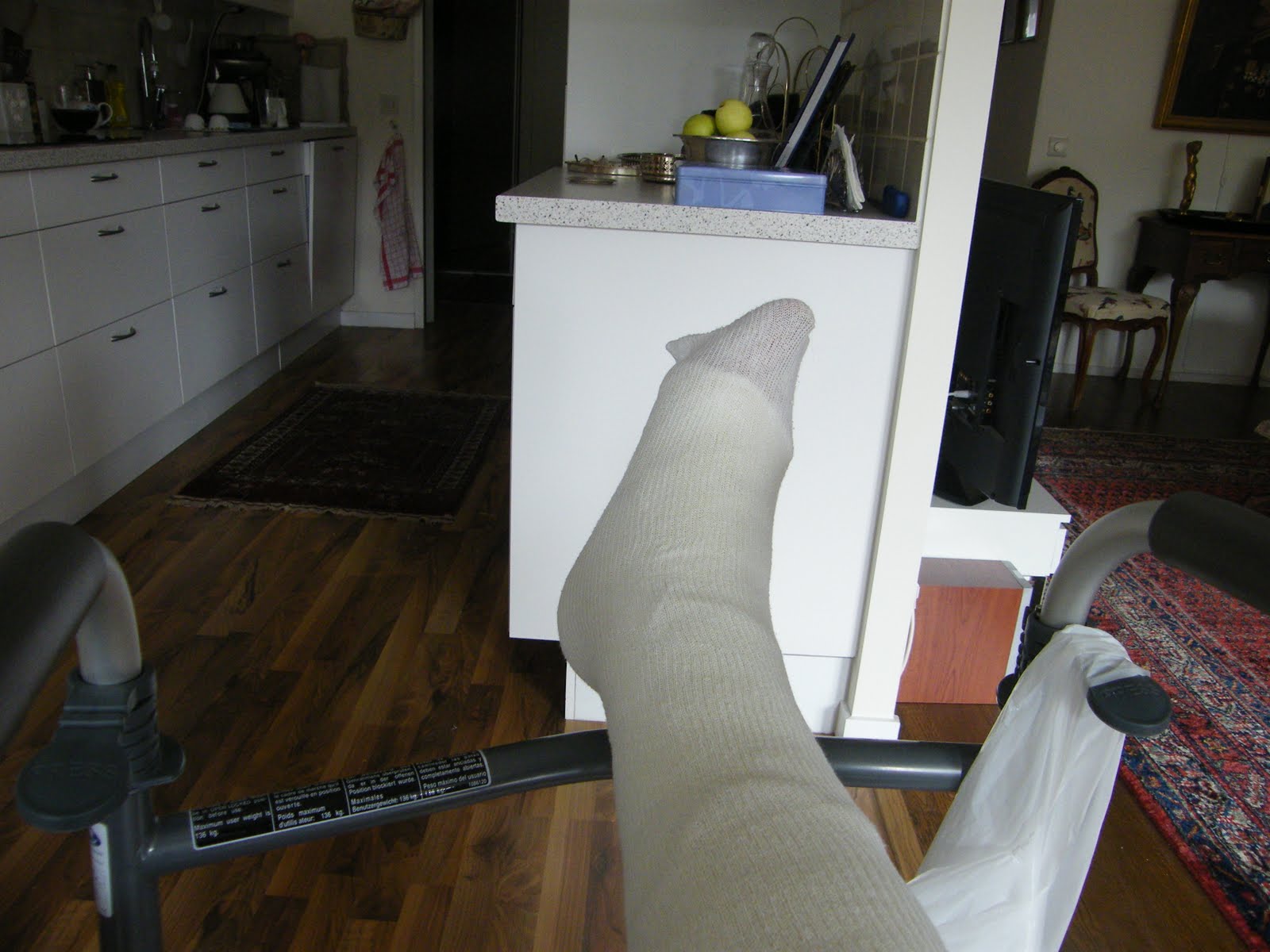 Magnus Åkermans blogg: Två månader med gipsat ben håller mig hemma!