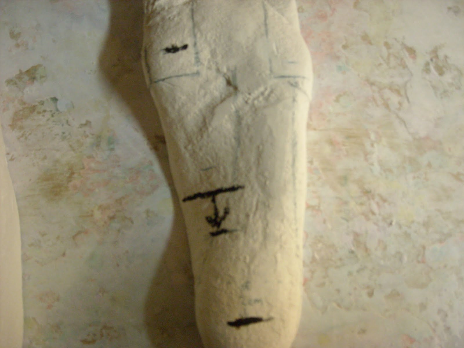 Foot and Ankle Problems By Dr. Richard Blake: Inverted Orthotic ...