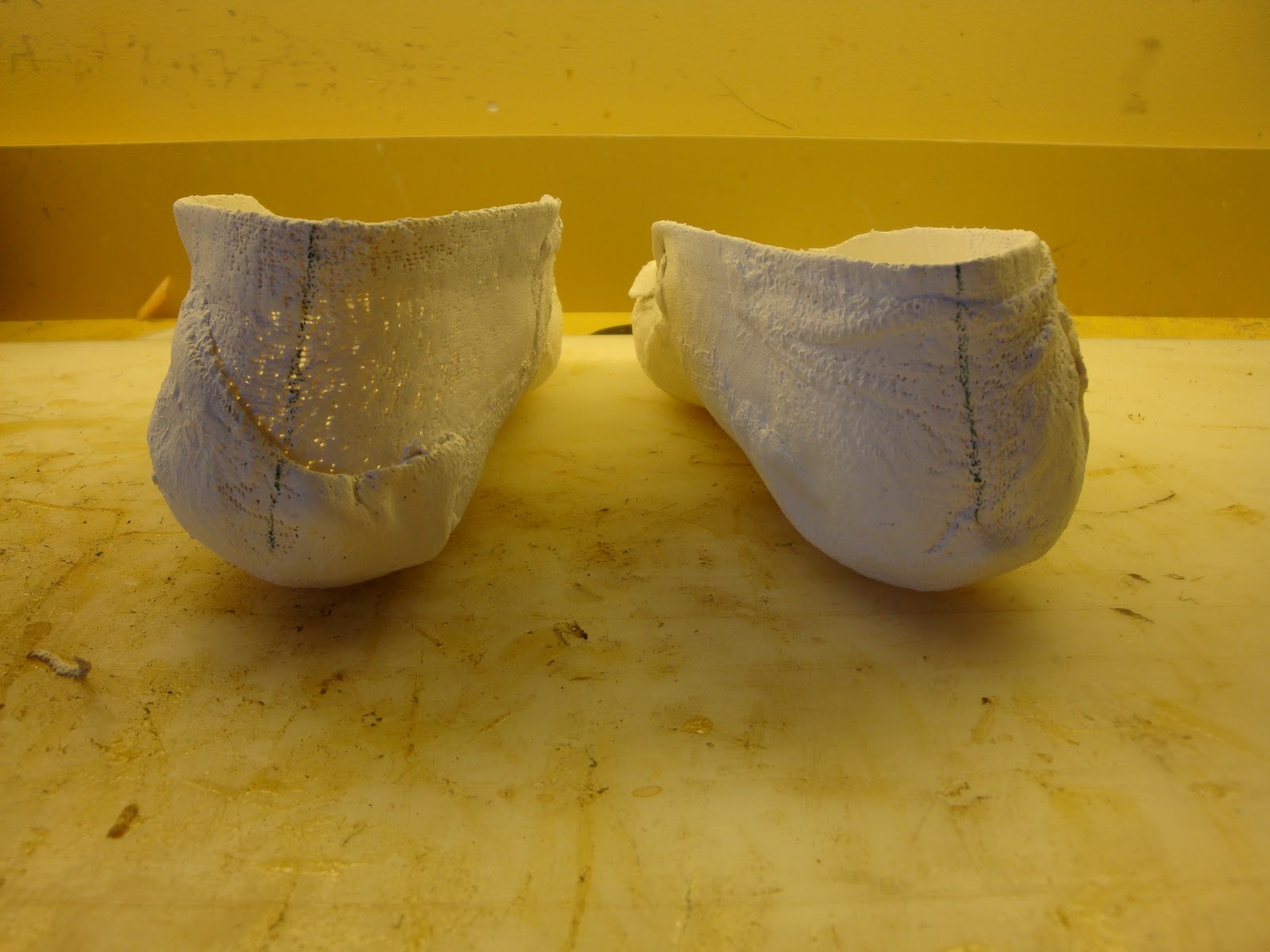 Foot and Ankle Problems By Dr. Richard Blake: Top 100 Biomechanical ...