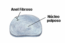 Escoliose: Constituição dos discos intervertebrais