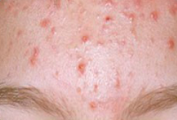 hair styles: mustache styles - The best idea for mustache styles