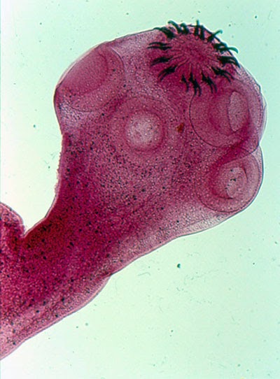 El mundo de las Tenias: Taenia Solium