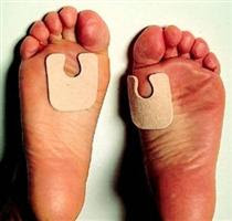 Advanced Footcare Clinic: What Are Calluses?