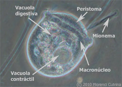 Vorticella sp. - El mundo de Hydra