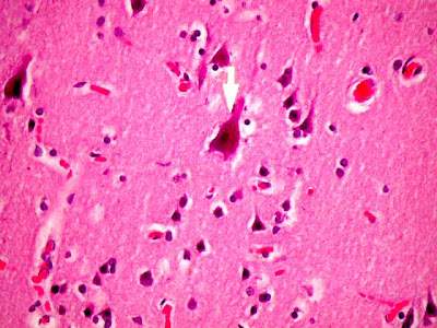 HISTOLOGIA SISTEMA NERVIOSO: Histologia del Córtex Cerebral