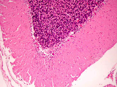 HISTOLOGIA SISTEMA NERVIOSO: Histologia del Cerebelo