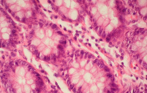 Histologia del Aparato Digestivo: Intestino grueso (Ciego, colon y ...