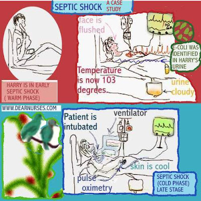 Dear Nurses: SEPTIC SHOCK ( WARM PHASE)