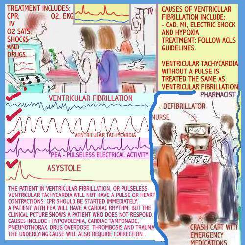 Dear Nurses: LEARNING MORE ABOUT LETHAL RHYTHMS