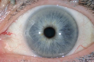 Tuesdays with Muerte: Myiasis