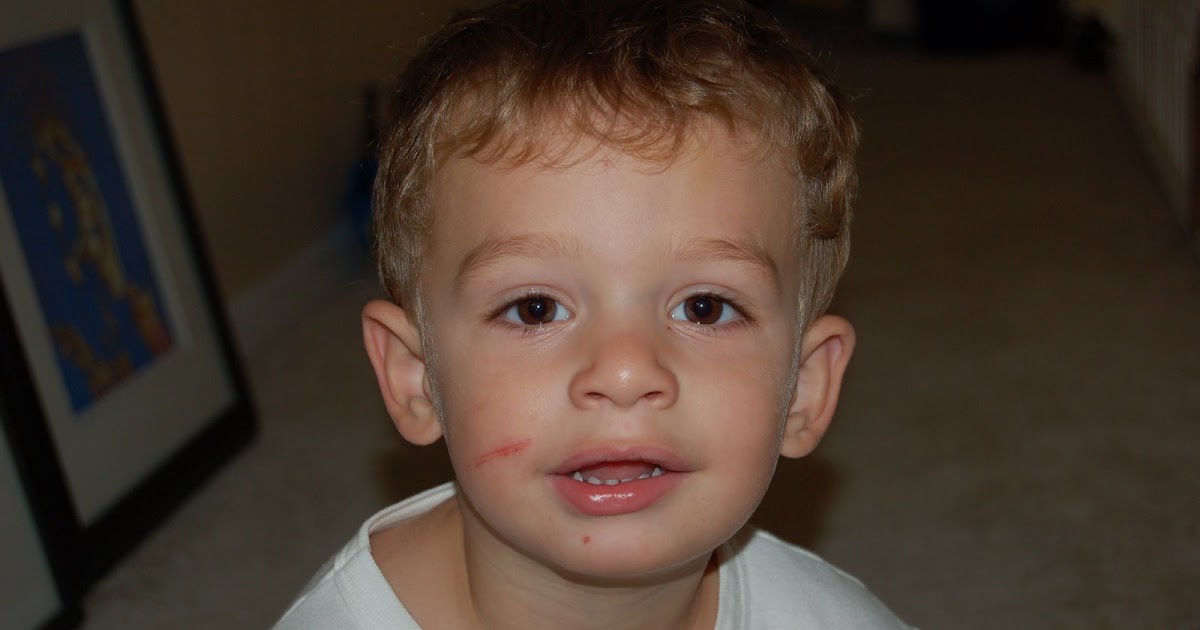 The Wollen Kids: Shaving Accident