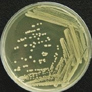 What Is The Arrangement Of Bacillus Megaterium