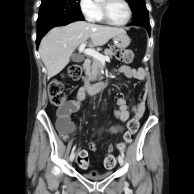 Radiology Cases: January 2010
