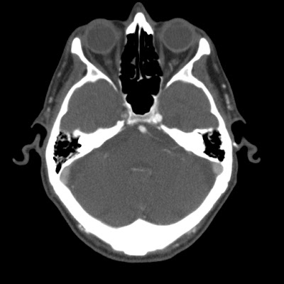 Radiology Cases: March 2010