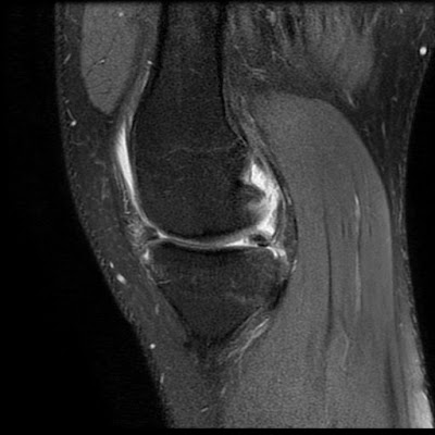 Radiology Cases: November 2008