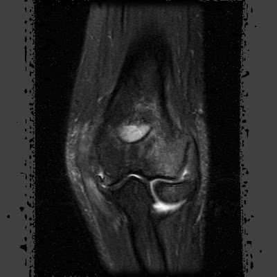 Radiology Cases: December 2008