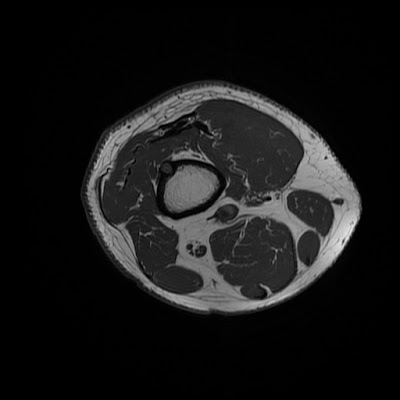 Radiology Cases: December 2008
