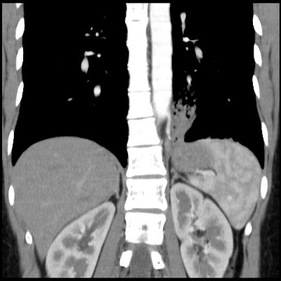 Radiology Cases: February 2009