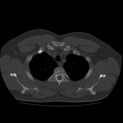 Radiology Cases: March 2009