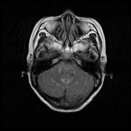 Radiology Cases: March 2009