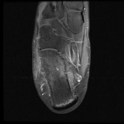 Radiology Cases: June 2010