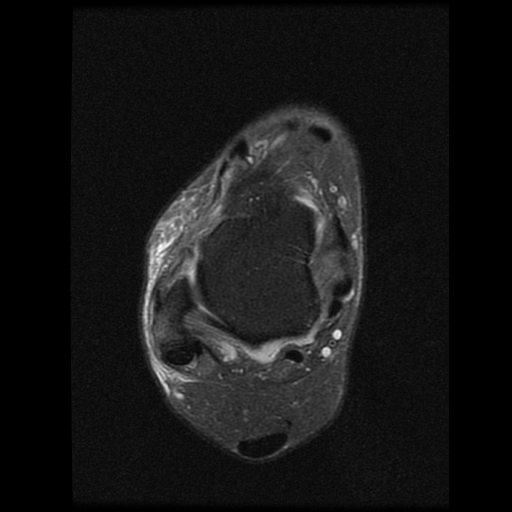 Radiology Cases: August 2010