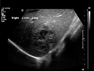Radiology Cases: August 2010
