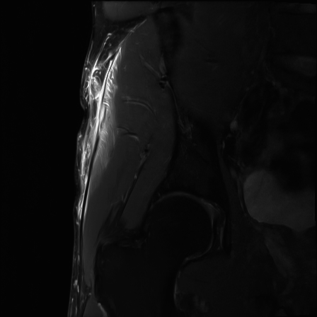 Radiology Cases: October 2010