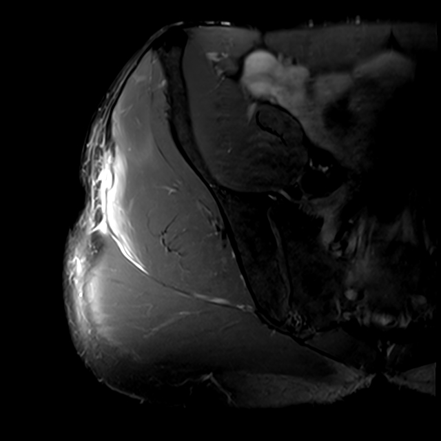 Radiology Cases: October 2010