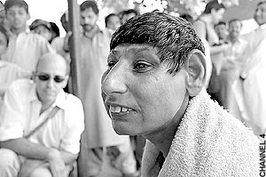 Two Eyed Jack: Small-headed Rat Children begging in the streets