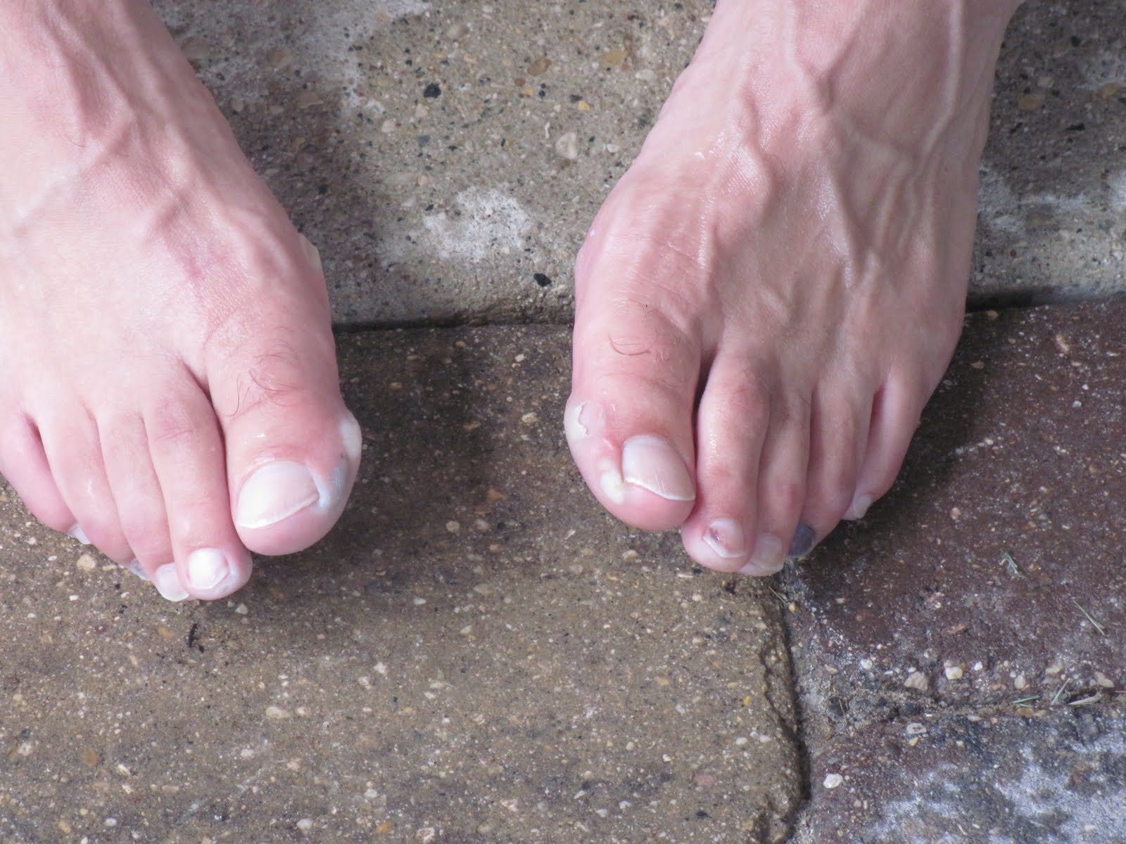 One Crazy Summer: back dimples and scapulae