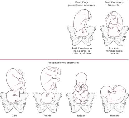 El Misterio de la Vida: Colocacion Fetal