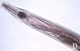 Parasite of the Day: June 10 -Syphacia obvelata
