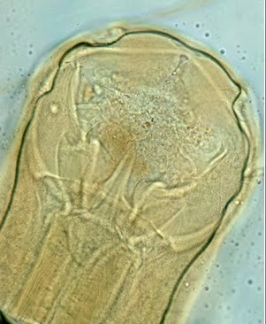 Parasite of the Day: October 18 - Necator americanus