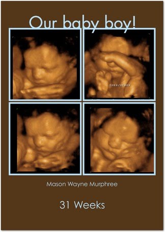 Just Me & My Boys: 3D Sonogram at 31 Weeks