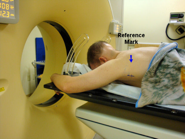 Marks Melon: 03/25/10 - Radiation Simulation