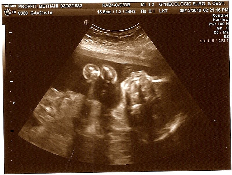 Three Ring Circus: 21 weeks (Ultrasound and check up)