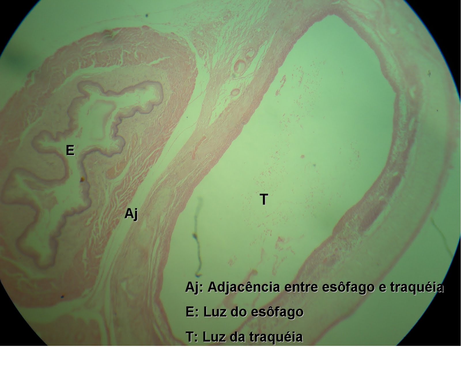 HISTOLOGIA-UFGD: (R1) ADJACÊNCIA ESÔFAGO E TRAQUÉIA, (40X)