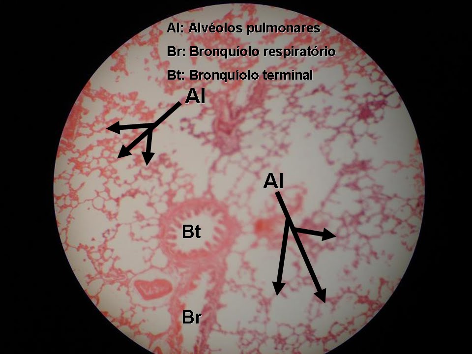 HISTOLOGIA-UFGD: (R13) DETALHE DE ALVÉOLOS, BRONQUÍOLO TERMINAL E ...