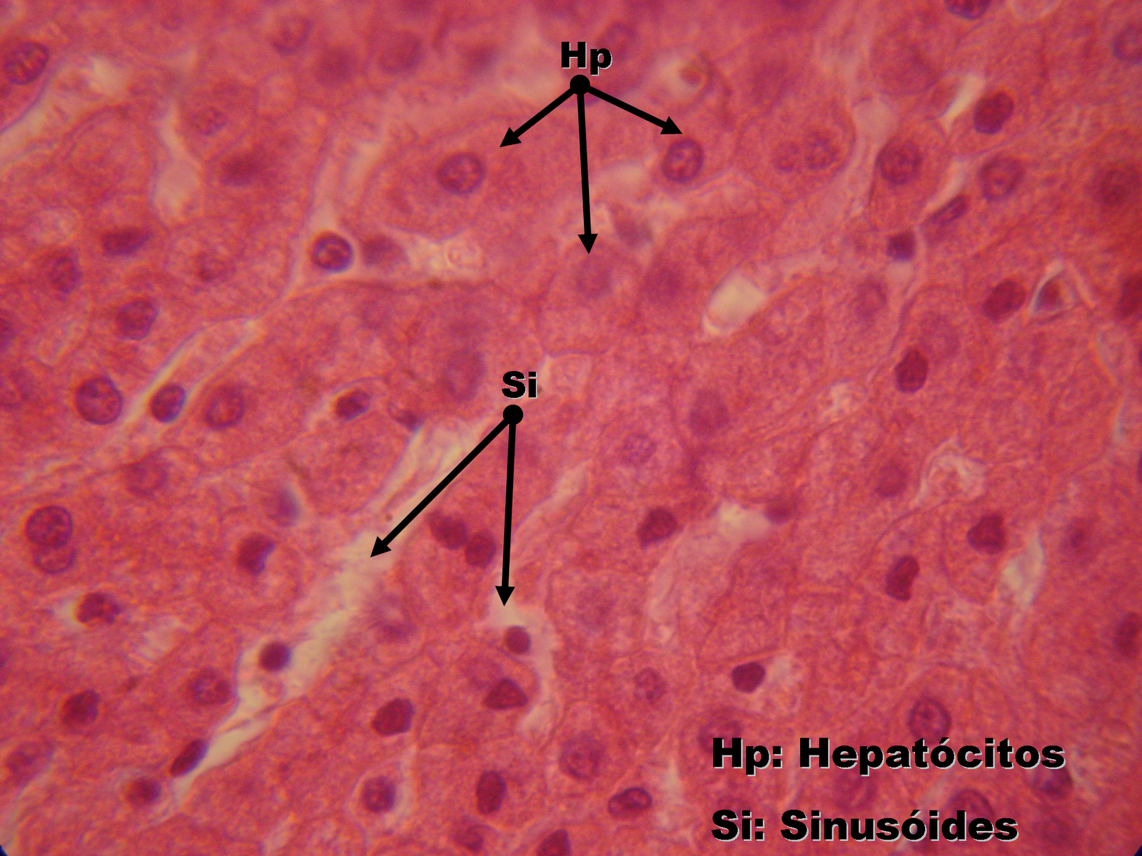 HISTOLOGIA-UFGD: (GD14) HEPATÓCITOS E SINUSÓIDES, (1000X)