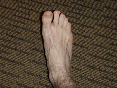 Can You Cross Your Toes?