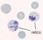 Laboratorium Kesehatan: Hitung Retikulosit