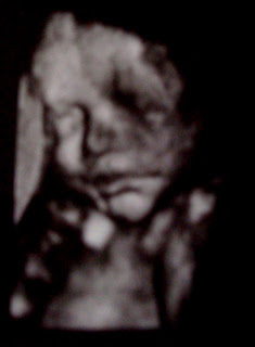Baby Emmel: 4D Ultrasound Pictures! (31 Weeks)