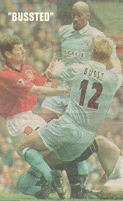 ON THE BENCH: Worst Leg Break Ever…..BUSSTED