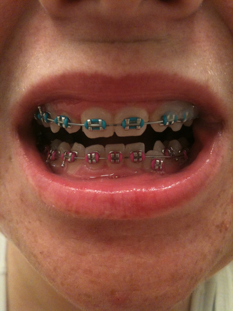 brace yourself: owwweeee