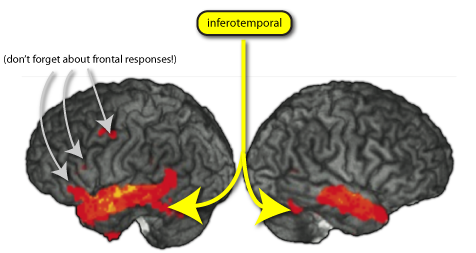 milozjam: Minus Et Cortex