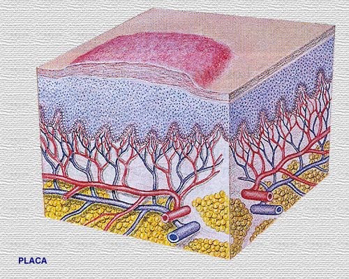 Estudiantes Vialenses de Ciencias Medicas: Atlas de Lesiones ...