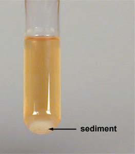 MicroA: Morphology In/On Culture Medium