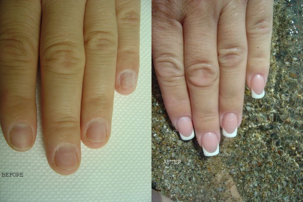 anna-nails: Γαλλικό,μόνιμο με τζέλ