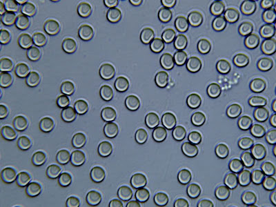 A travers le microscope d'Eyal: Sang et banane